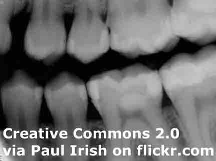 Breaking News English | Grammar | Human Teeth