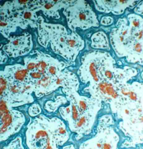 Third State - ESL Lesson Plan - Breaking News English Lesson